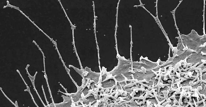 Prevedere con l'Ai come un virus evolverà semplicemente guardando alla ...